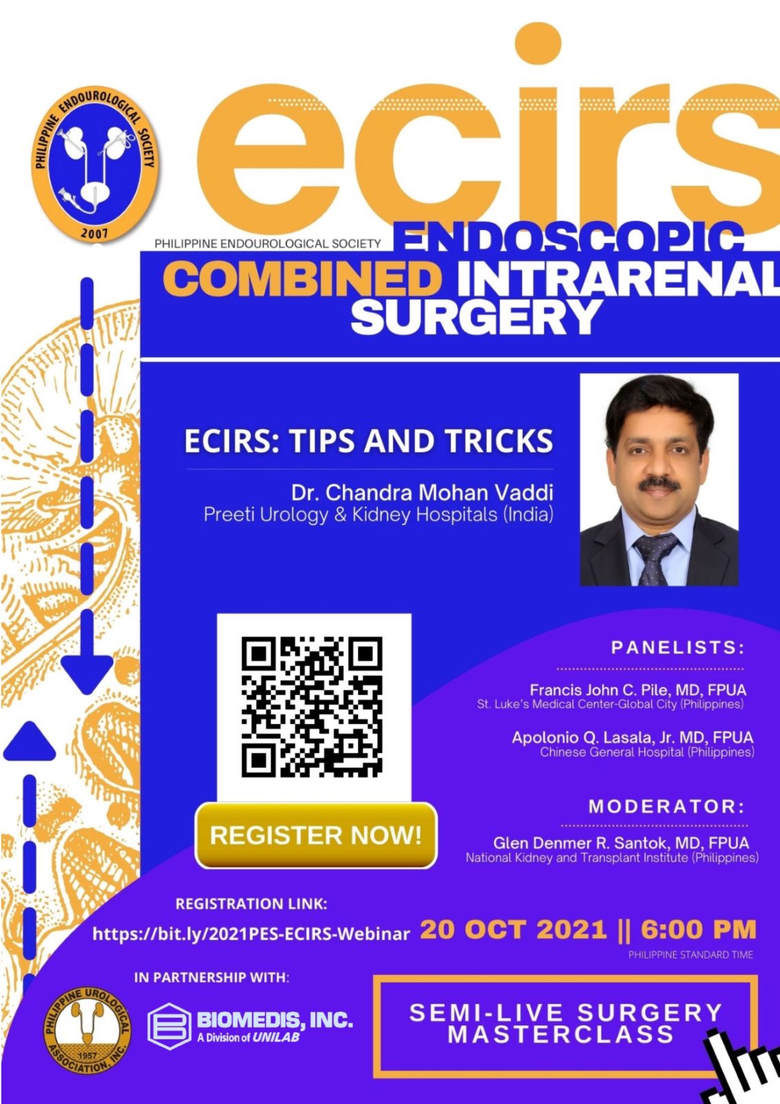 ENDOSCOPIC COMBINED INTRARENAL SURGERY ECIRS: TIPS AND TRICKS ...